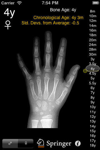 Bone Age Medical Skeletal Maturity Digital Atlas